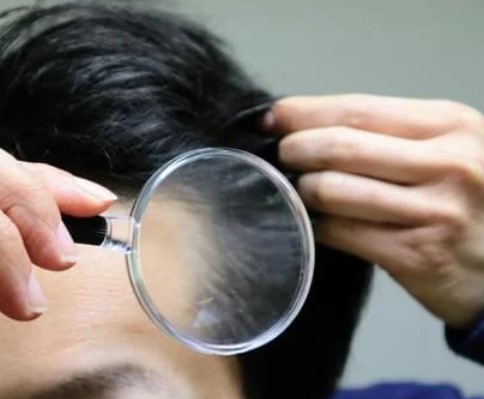 ミノキシジルで産毛止まり？太くならない5つの原因と確実に太くする対処法 | ケンコープラスブログ